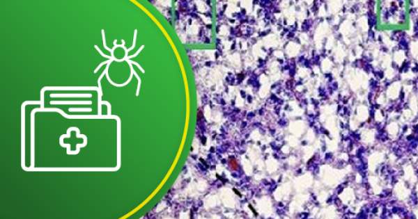 Acanthocytosis and brain damage in area postrema and choroid plexus ...