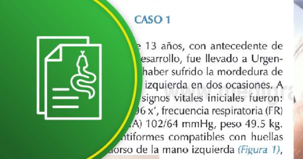 Ofidiotoxicosis por cascabel pigmea (Crotalus ravus): reporte de dos ...